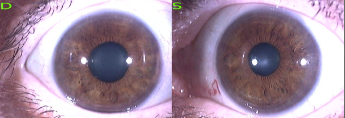 Eye Photography Tips & Tricks - Clinical Neuro-Optic Reseach Institute