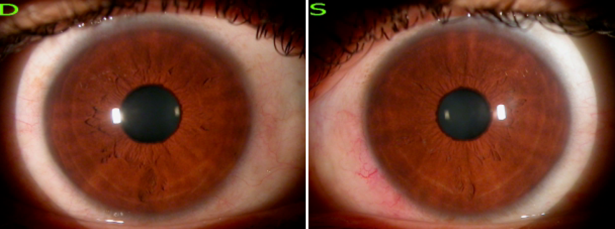 Eye Photography Tips & Tricks - Clinical Neuro-Optic Reseach Institute
