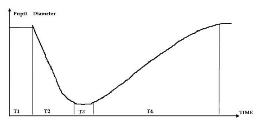 Human Pupil Reflexes - Clinical Neuro-Optic Reseach Institute