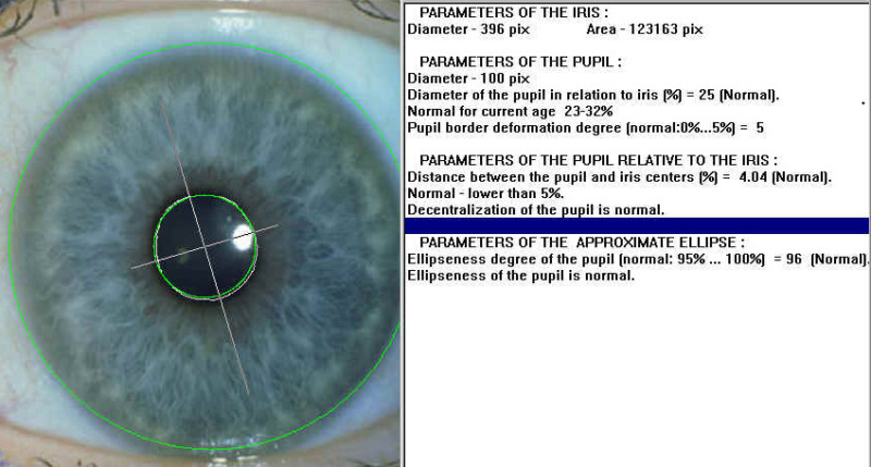 The Human Pupil - Clinical Neuro-Optic Reseach Institute